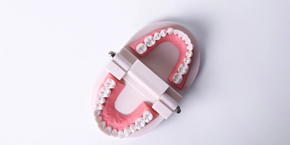 Advancements in Bioengineered Teeth Promise Revolution in Dental ...